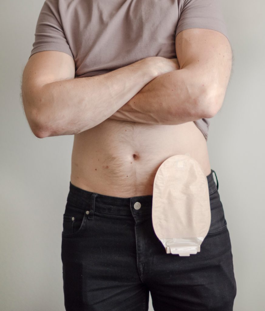 Professionelle Stomaversorgung - Infektionsvorbeugung